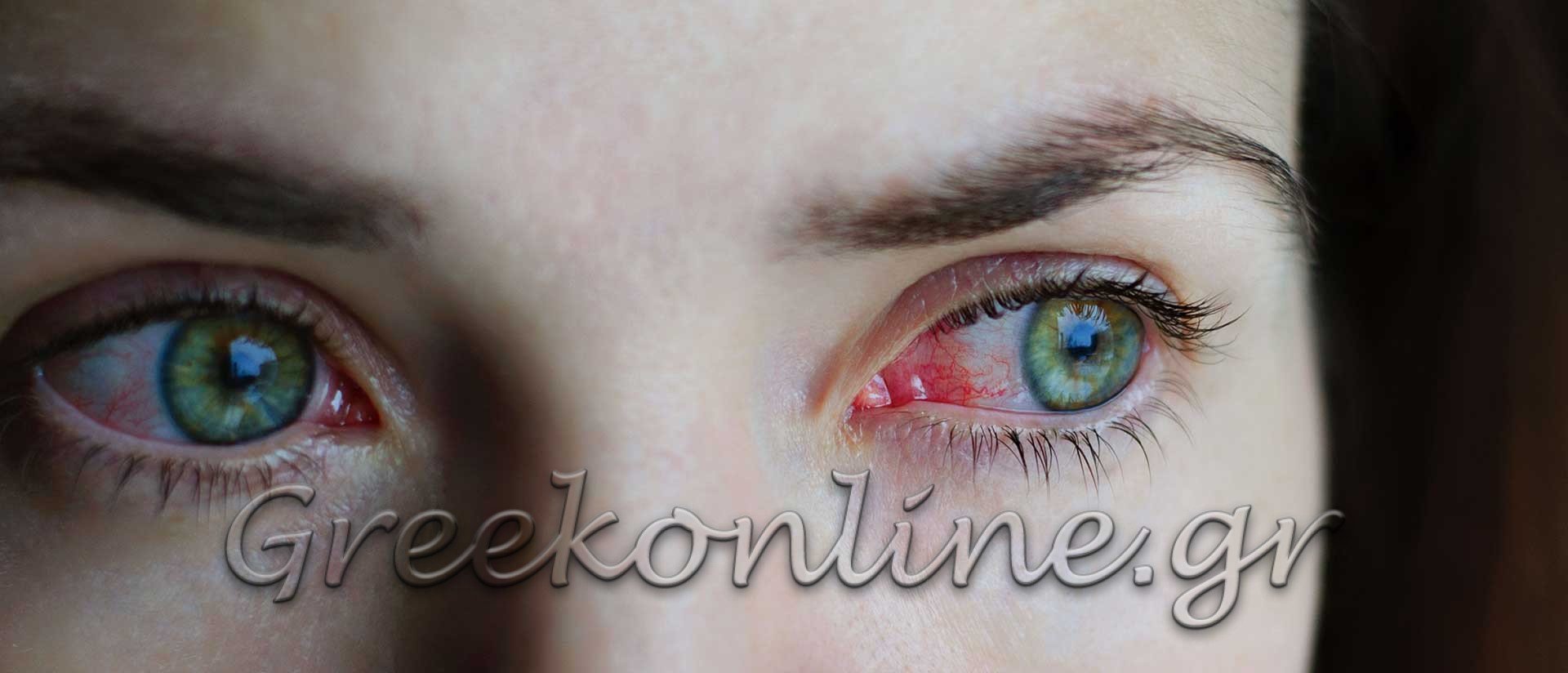 ΧΕΙΡΟΥΡΓΟΣ ΟΦΘΑΛΜΙΑΤΡΟΣ ΘΕΣΣΑΛΟΝΙΚΗ ΚΕΝΤΡΟ "ΨΥΛΛΑ ΜΥΡΣΙΝΗ ...